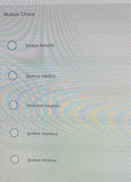 Solved Which structure is highlighted? Multiple Choice O | Chegg.com