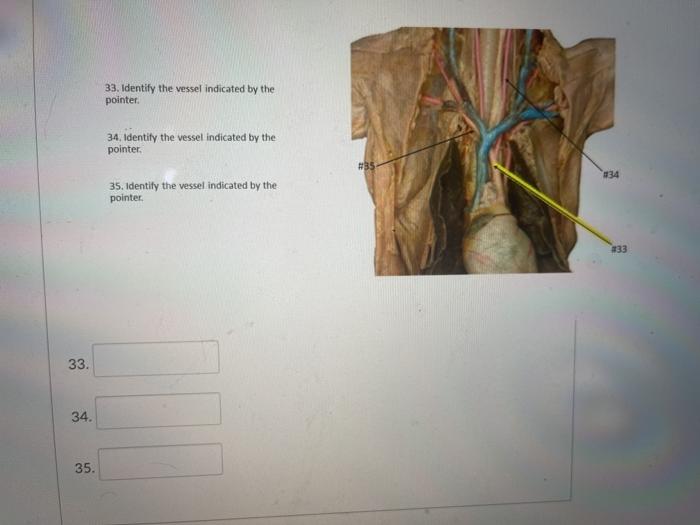 Solved 33. Identify the vessel indicated by the pointer 34. | Chegg.com