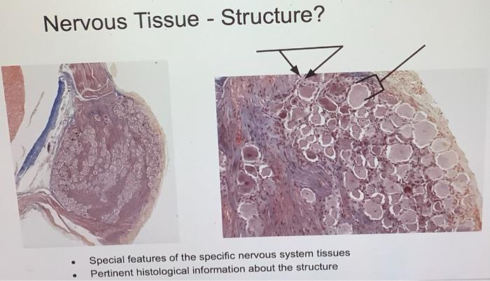 Solved Nervous Tissue - Structure? Special features of the | Chegg.com