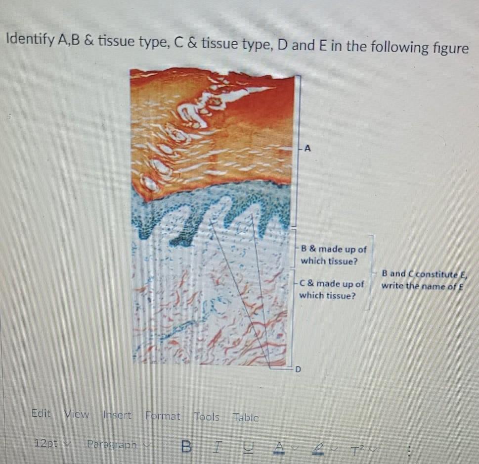 Solved Identify A,B & tissue type, C & tissue type, D and E | Chegg.com