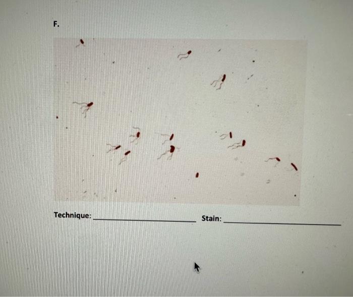 Solved 12. Identify simple stain, negative stain, gram | Chegg.com