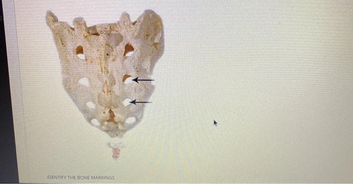 Solved IDENTIFY THE BONE MARKINGS | Chegg.com