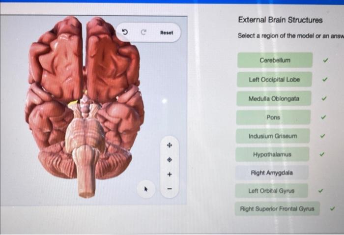 External Brain Structures Select a region of the | Chegg.com