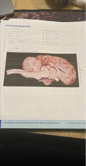 Solved is the labeling right ? if not can you help me ? I | Chegg.com