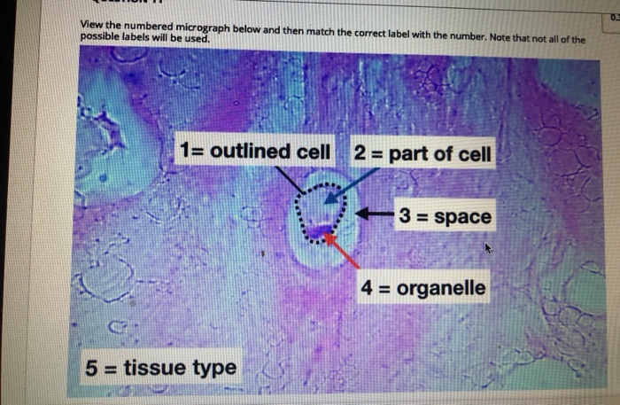 Solved 0 View the numbered micrograph below and then match | Chegg.com