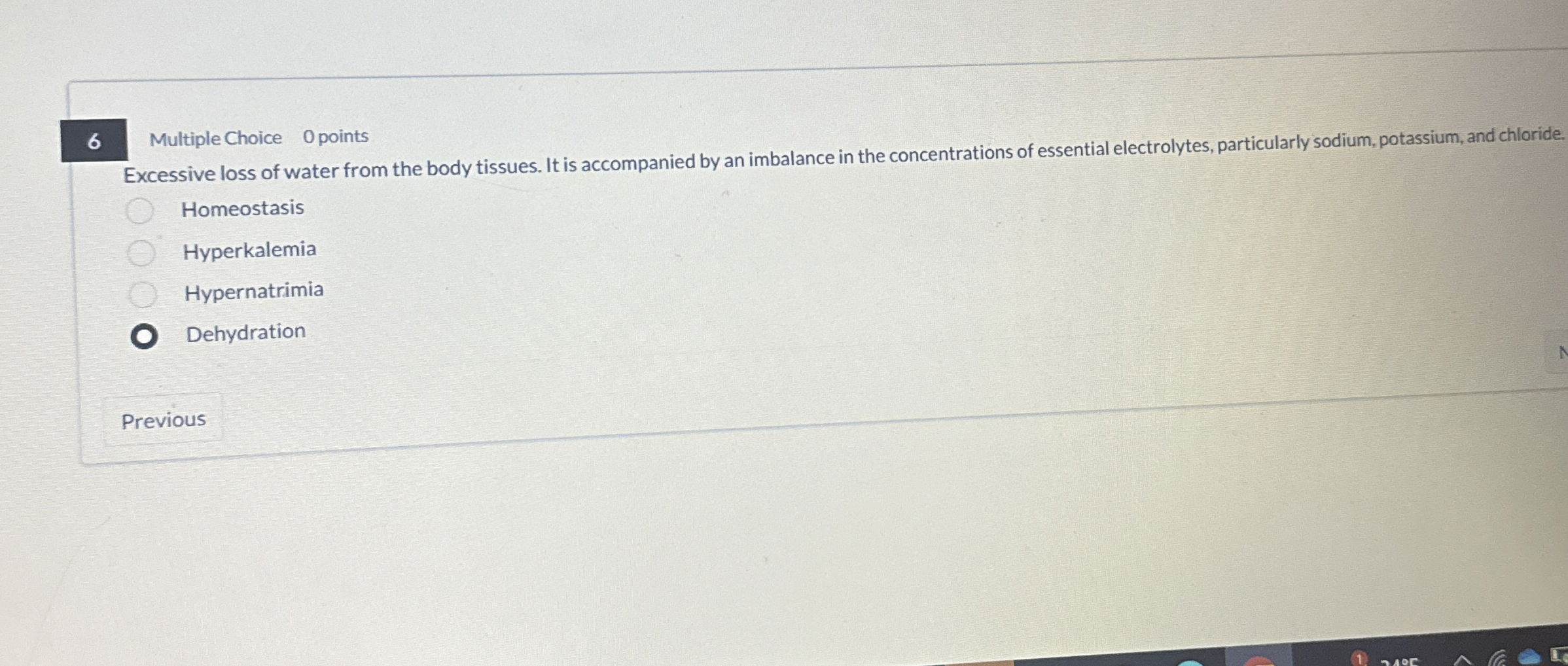 Solved 6Multiple Choice 0 ﻿pointsExcessive loss of water | Chegg.com