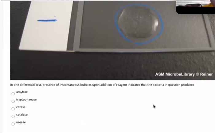 Solved ASM MicrobeLibrary © Reiner In one differential test, | Chegg.com