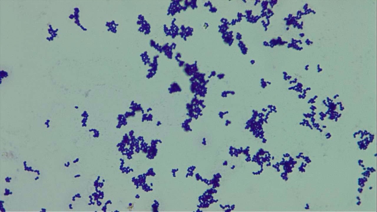 Solved Gram Stain: Unknown #9 ﻿Report the Gram reaction. | Chegg.com