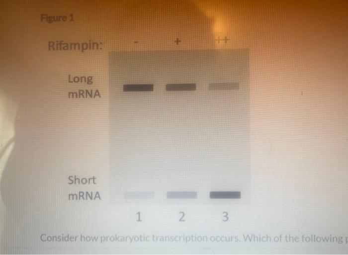 Solved consider now prokaryouc transcription occurs. | Chegg.com