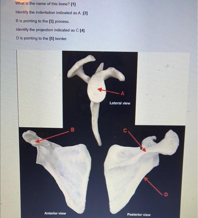 Solved What is the name of this bone? [1] Identify the | Chegg.com