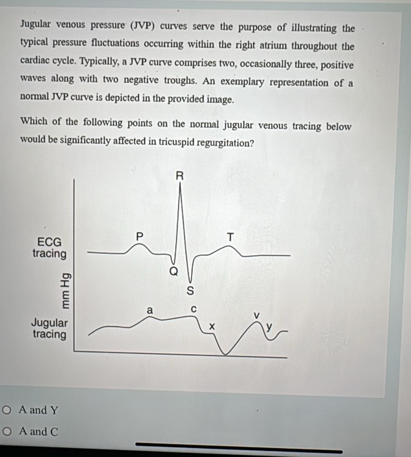 Solved Jugular venous pressure (JVP) ﻿curves serve the | Chegg.com