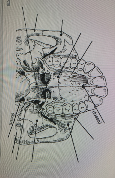 Solved (fossa) (fossa) | Chegg.com