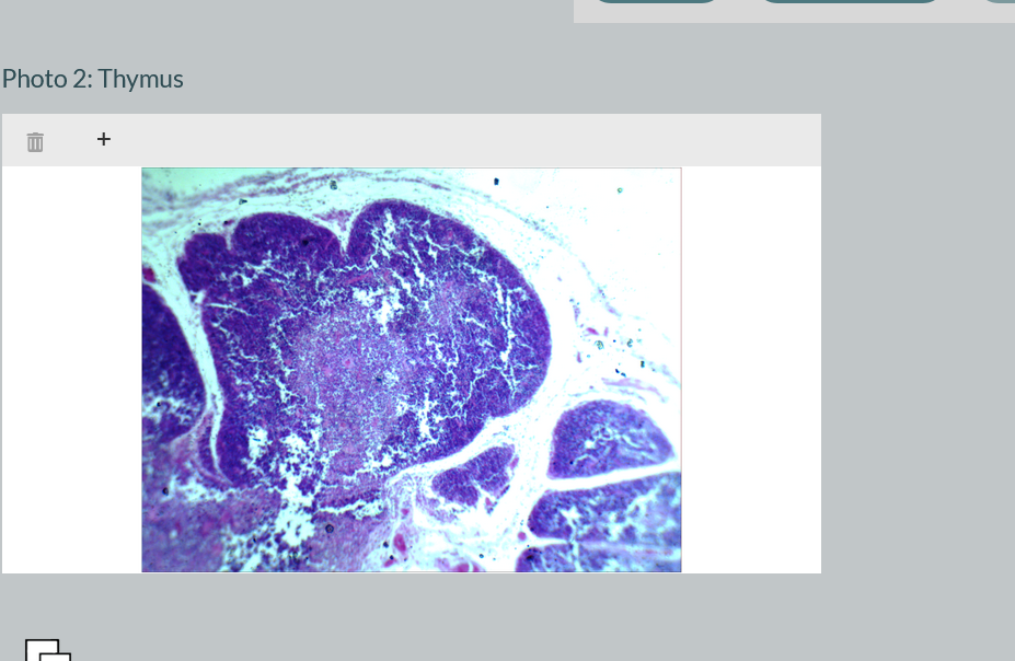 Solved Label the lobule, medulla, and cortex of the thymus | Chegg.com