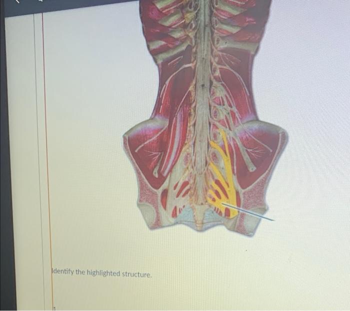 Solved Identify the highlighted structure, | Chegg.com