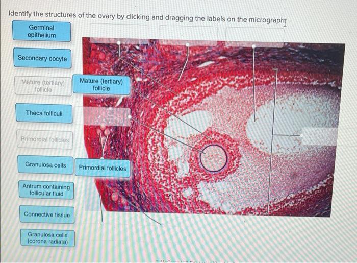 Solved Identify the structures of the ovary by clicking and | Chegg.com