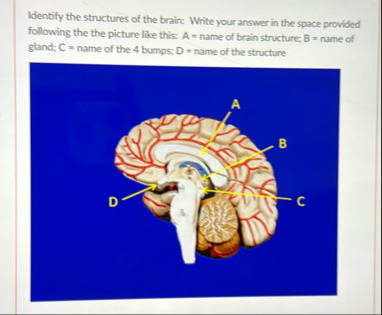 Identify the structures of the brain: Write your | Chegg.com