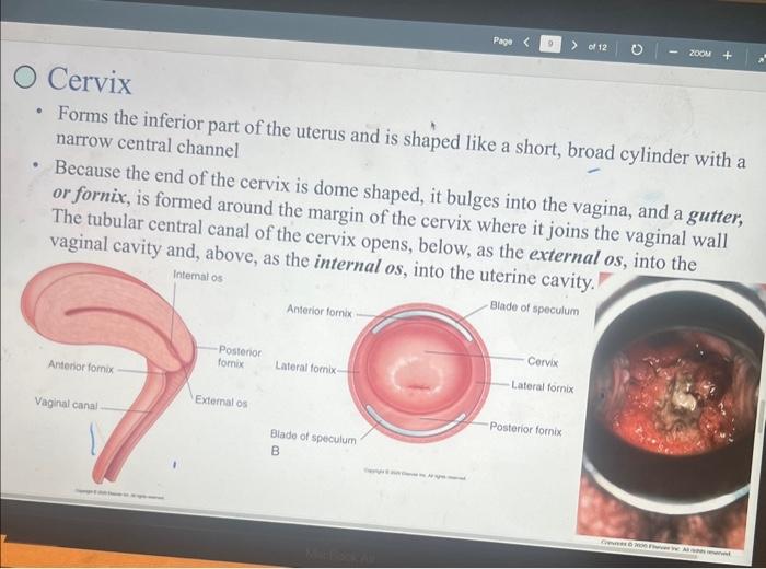 Solved explain whats wrong with the cervix in this picture | Chegg.com