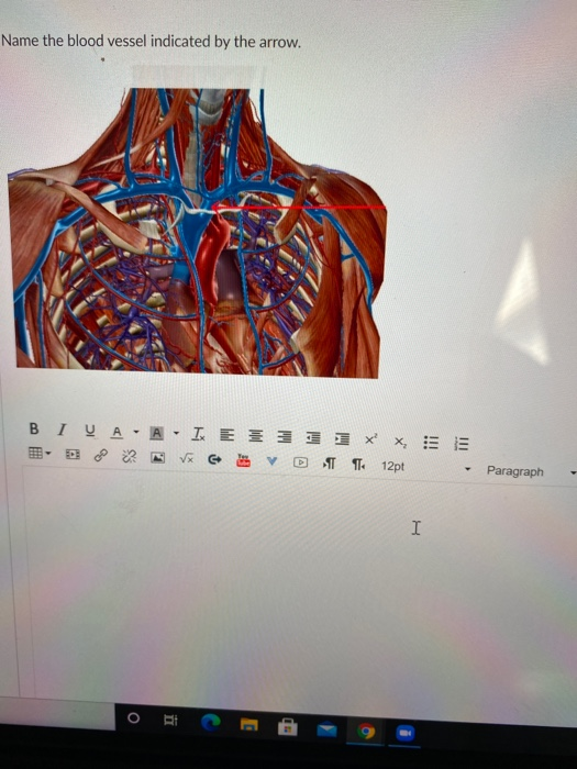 Solved Name the blood vessel indicated by the arrow. BIVA | Chegg.com