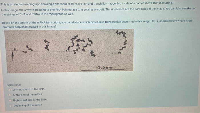 Solved This is an electron micrograph showing a snapshot of | Chegg.com