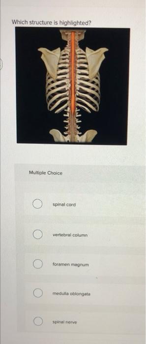 Solved Which structure is highlighted? Multiple Choice O | Chegg.com