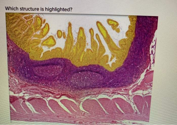 Which structure is highlighted? mm muscularis of | Chegg.com