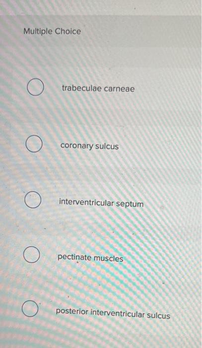 Solved Which structure is highlighted? Multiple Choice | Chegg.com