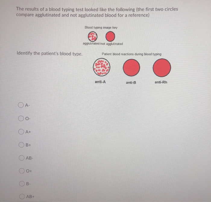 Solved The results of a blood typing test looked like the | Chegg.com