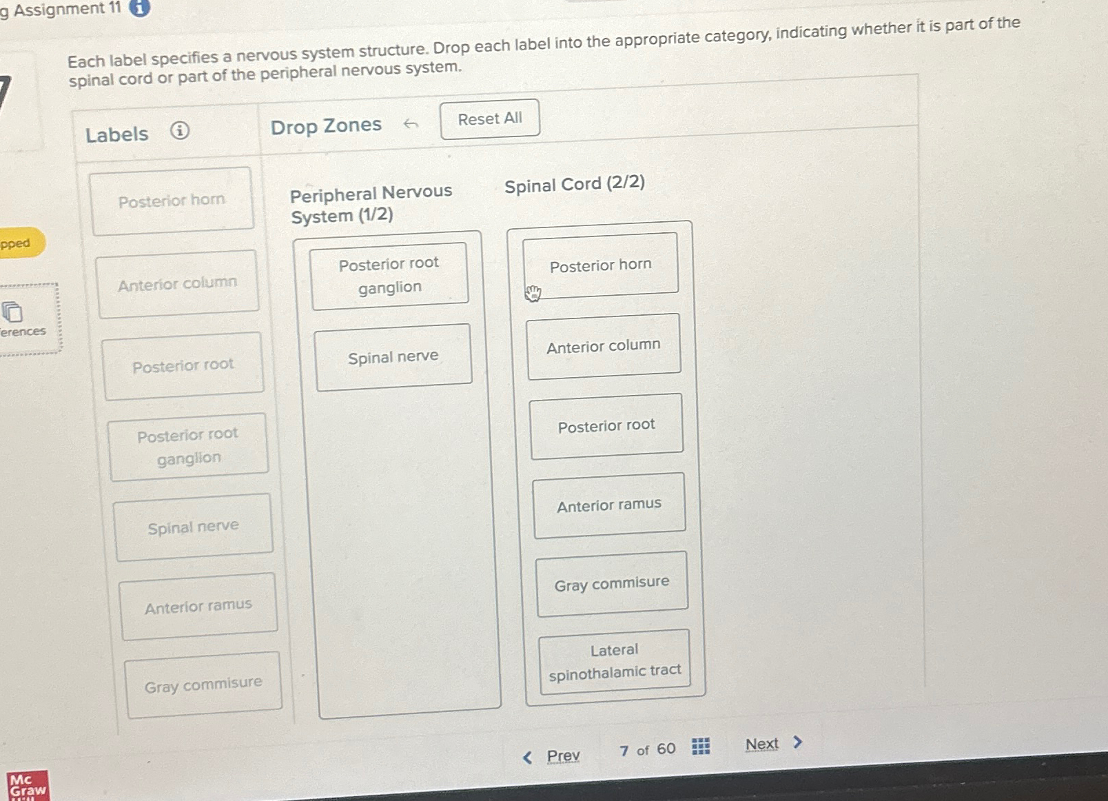 Solved g Assignment 11Each label specifies a nervous system | Chegg.com