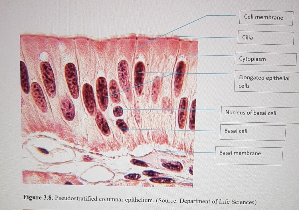 Solved only annotate elongated epithelial cells , basal cell | Chegg.com