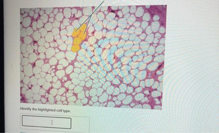 Solved Identify The Highlighted Cell Type I Chegg