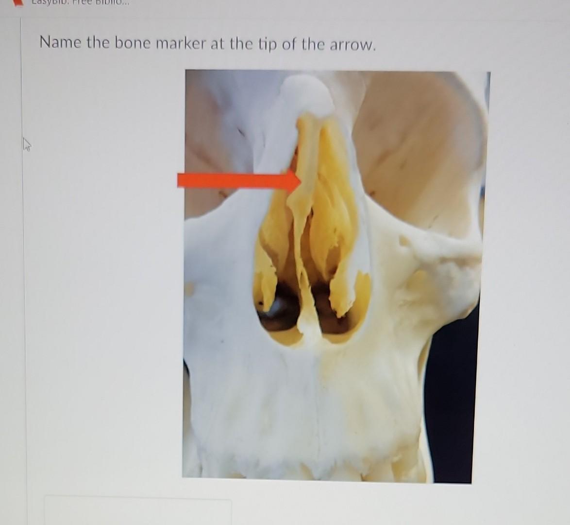 Solved Name the bone marker at the tip of the arrow. Name | Chegg.com