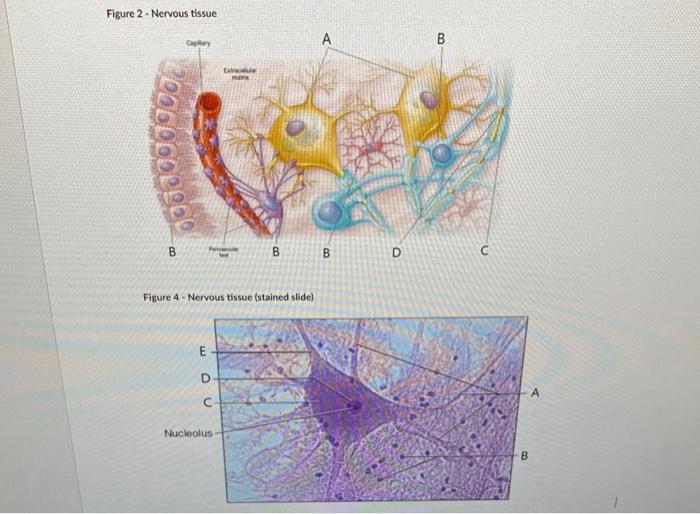 Solved Figure 2. Nervous tissue Figure 4 - Nervous tissue | Chegg.com