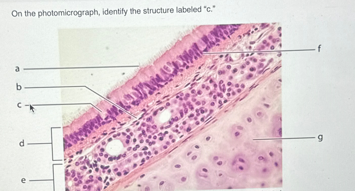 Solved On the photomicrograph, identify the structure | Chegg.com