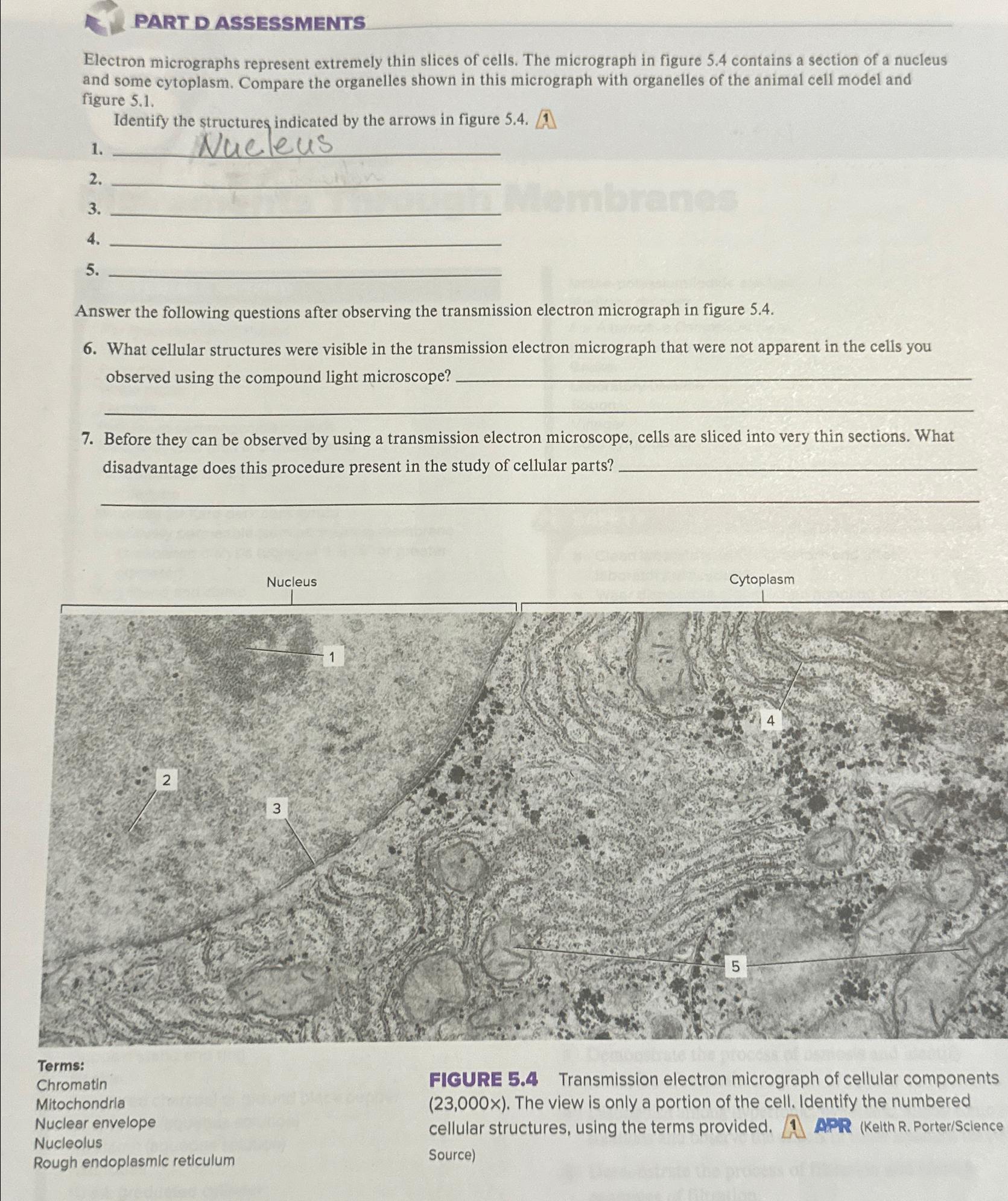 Solved PART D ASSESSMENTSElectron micrographs represent | Chegg.com