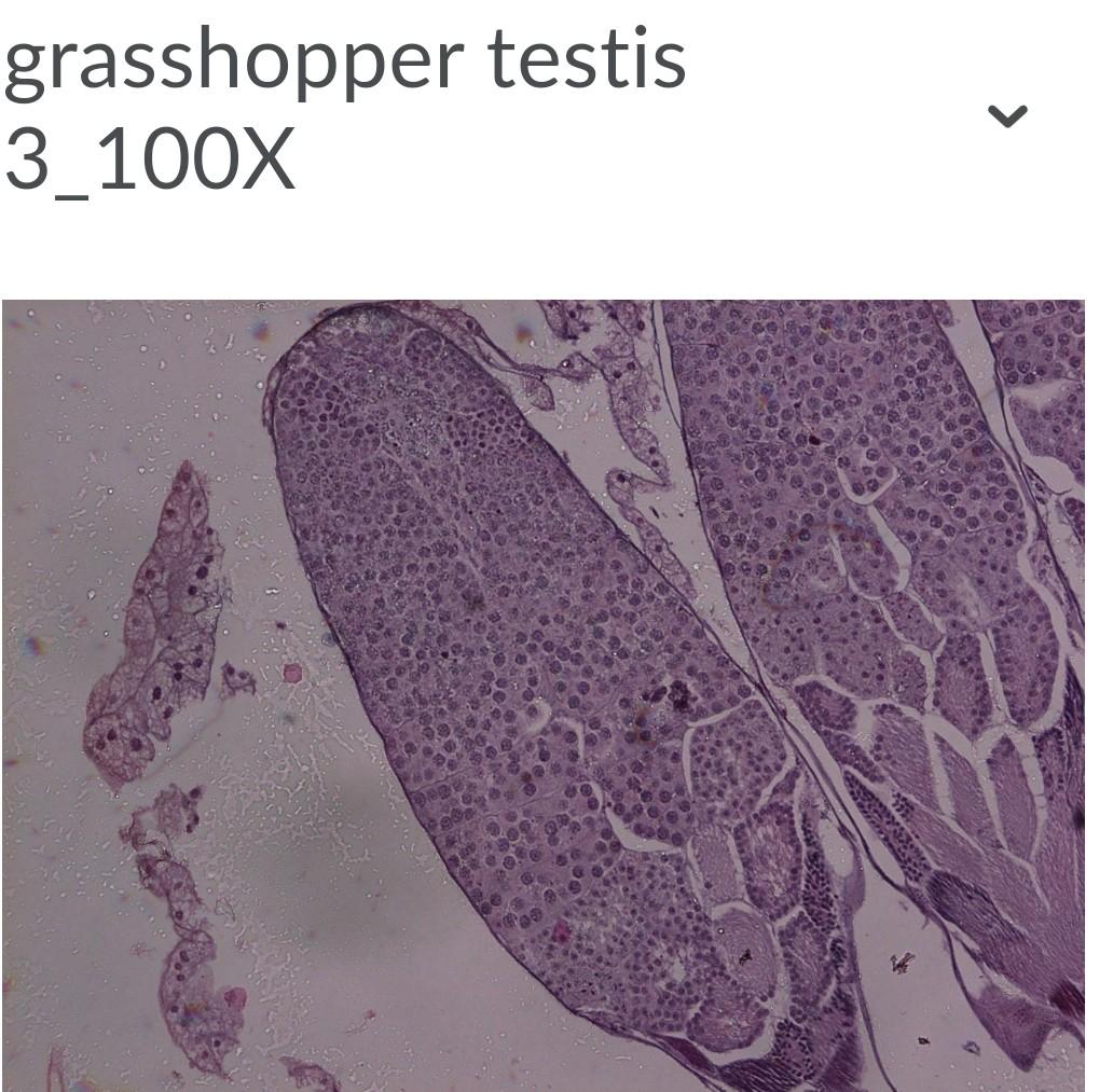 Solved grasshopper testis 3_100X
