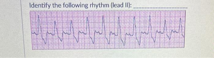 Solved Identify the following rhythm (lead II): | Chegg.com