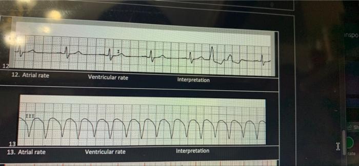 Solved use the pictures below to identify the rhythms and | Chegg.com