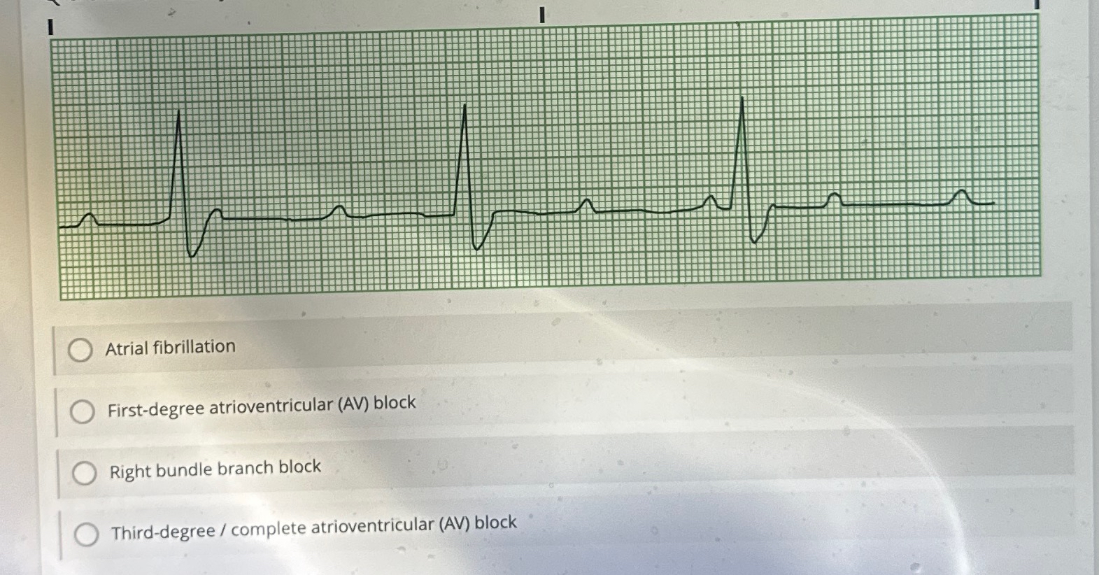 Solved Atrial fibrillationFirst-degree atrioventricular (AV) | Chegg.com