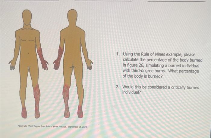 Solved 1. Using the Rule of Nines example, please calculate | Chegg.com