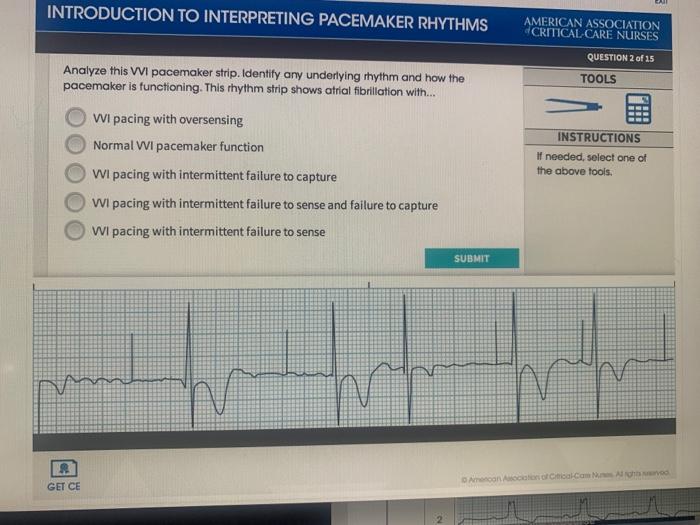 Solved Analyze this VVI pacemaker strip. Identify any | Chegg.com