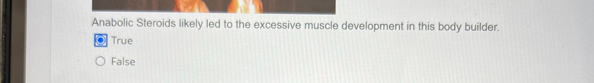 Solved Anabolic Steroids likely led to the excessive muscle | Chegg.com