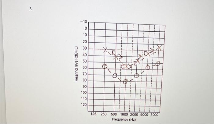 Solved Instructions: Interpret the audiograms below and | Chegg.com