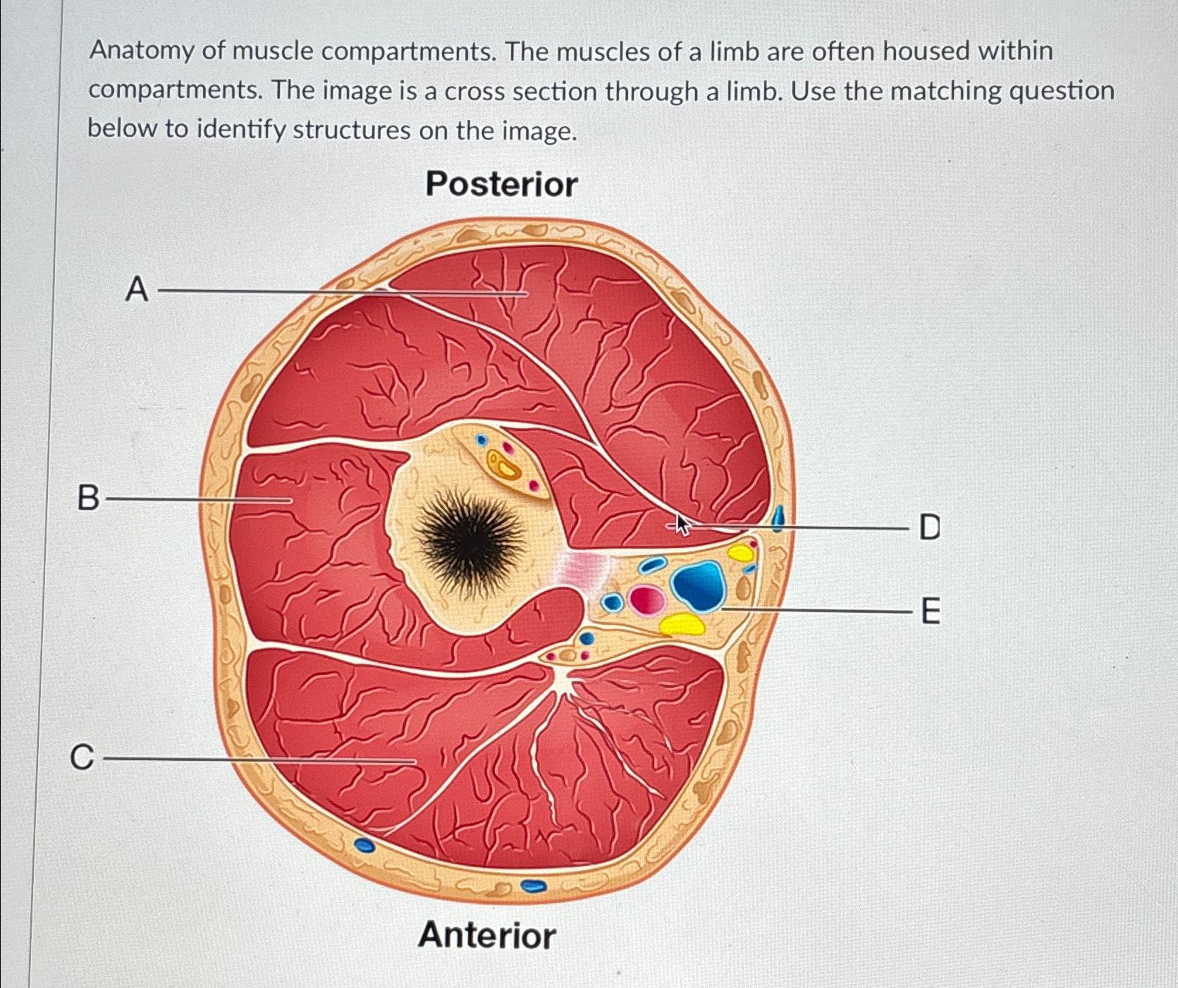 Solved Anatomy of muscle compartments. The muscles of a limb | Chegg.com