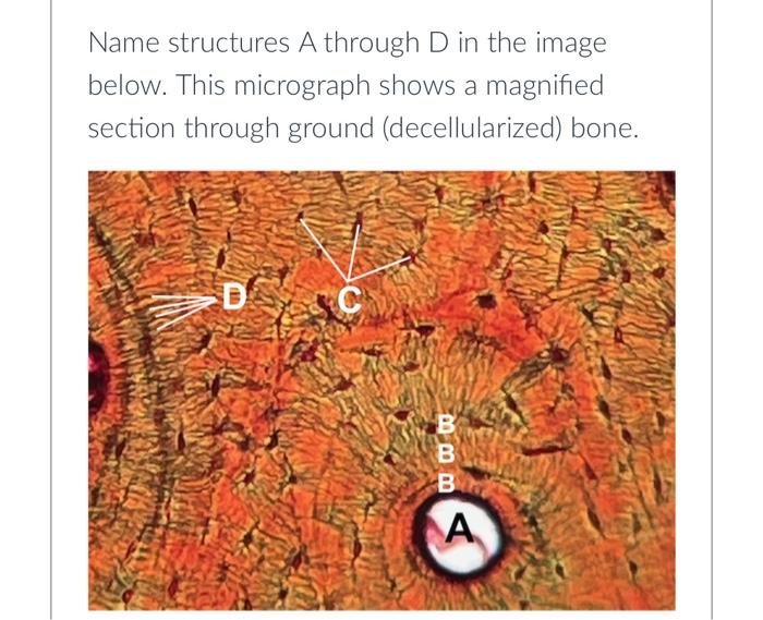 Solved Name structures A through D in the image below. This | Chegg.com