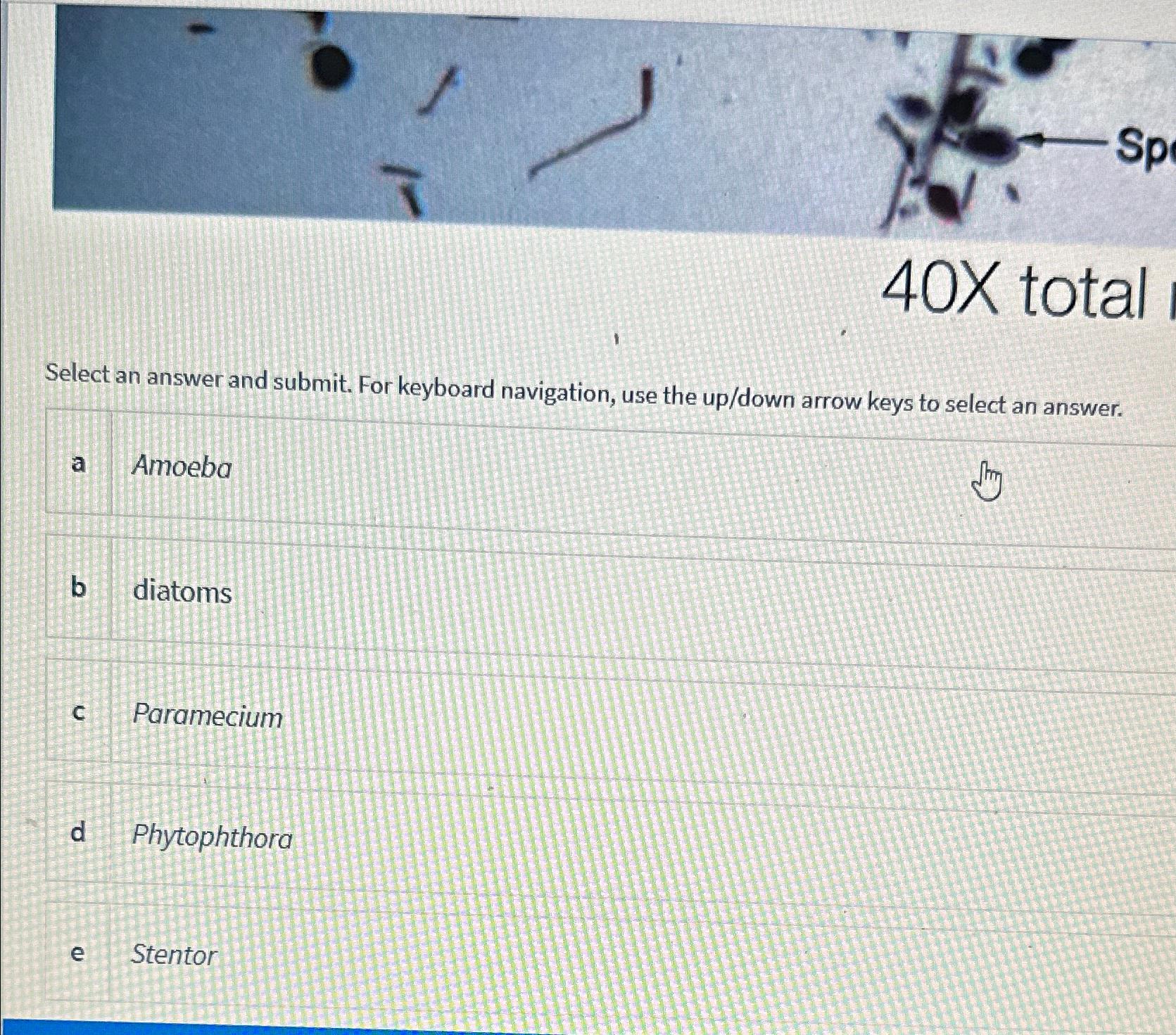 Solved Identify the potato blight-causing protist(s) | Chegg.com