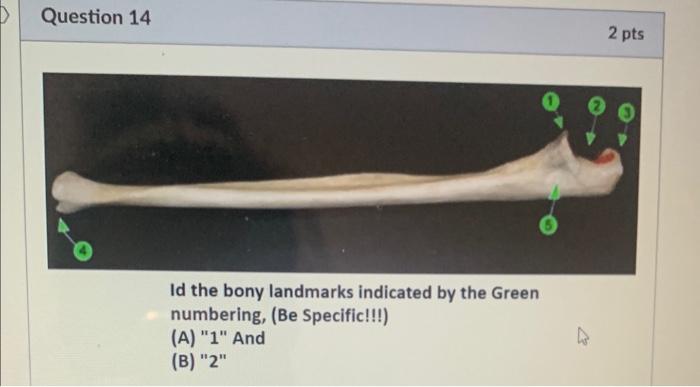 Solved Question 14 Id the bony landmarks indicated by the | Chegg.com