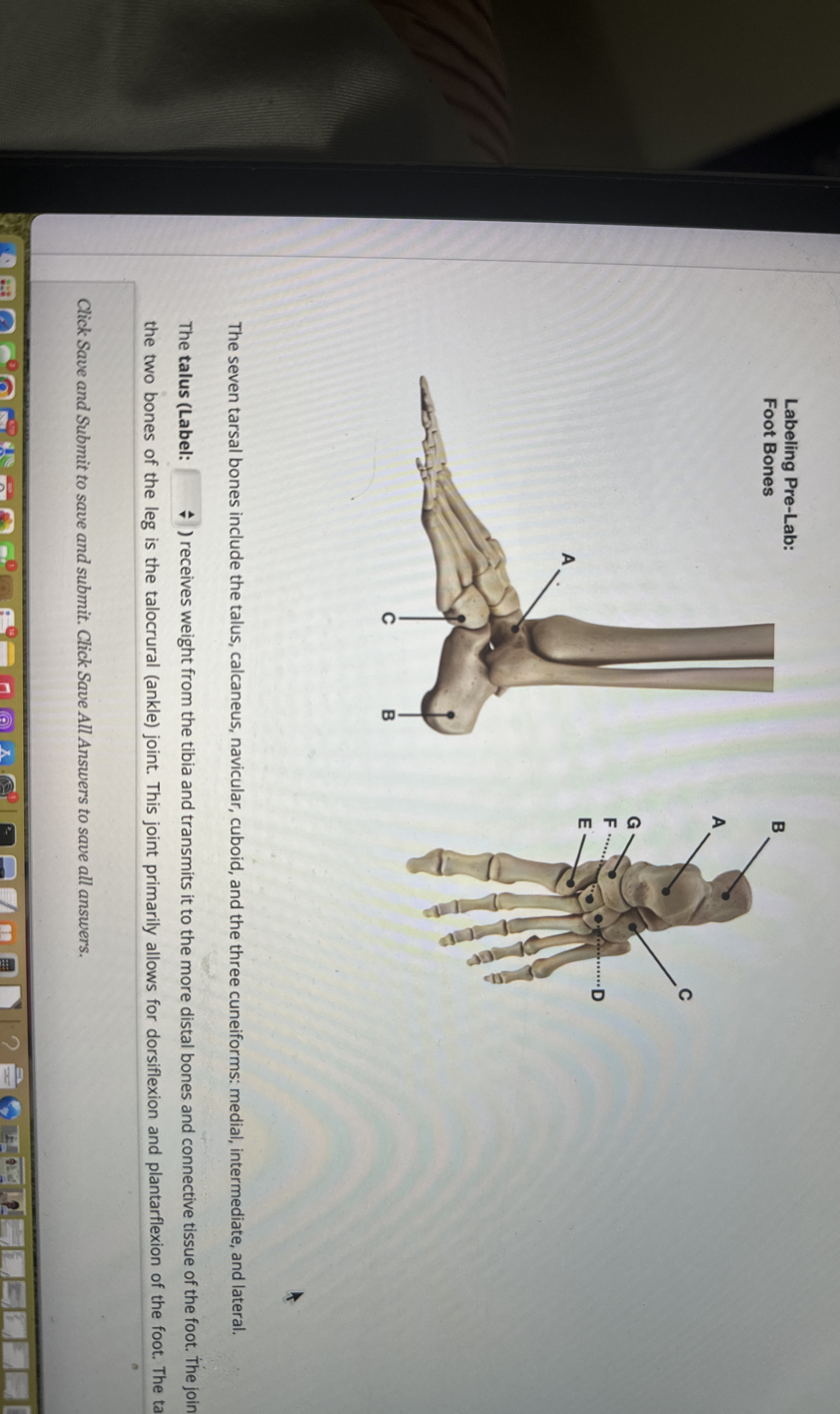 Solved The seven tarsal bones include the talus, calcaneus, | Chegg.com