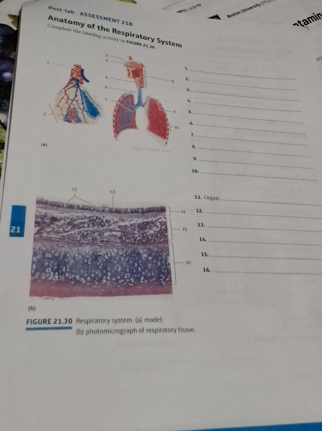 Solved by an EXPERT Post-lab ASSESSMENT 21 ﻿BAnatomy of the Respiratory ...