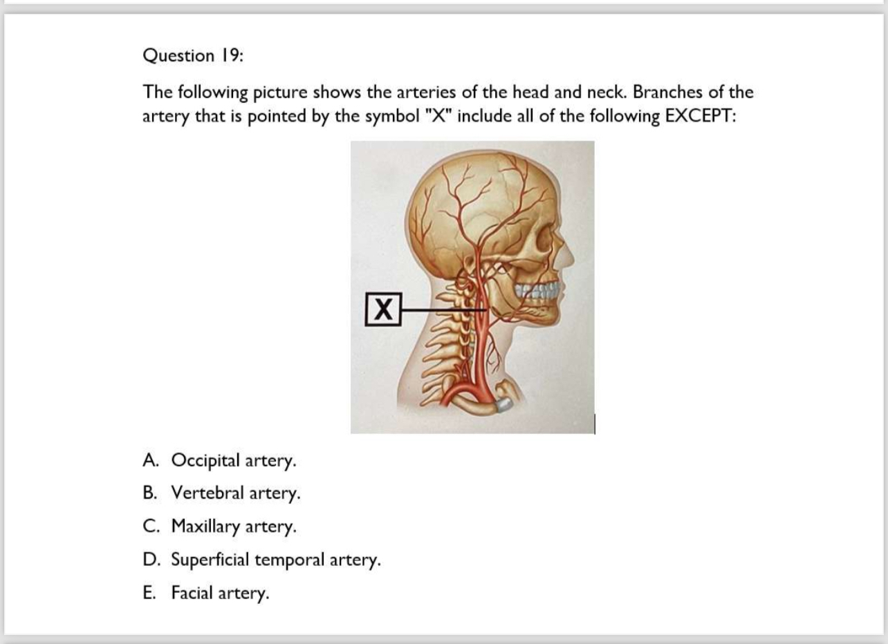 Solved Question 19:The following picture shows the arteries | Chegg.com