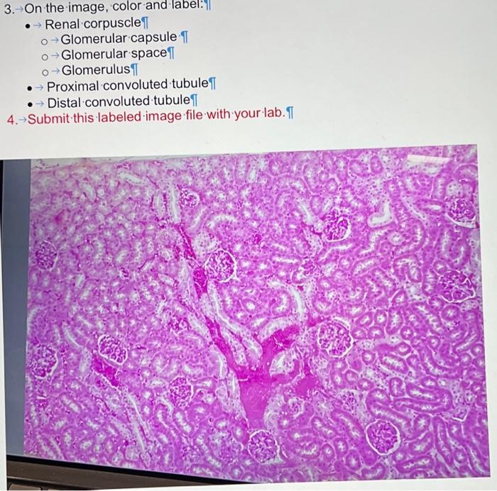 Solved 3. → On the image, color and label: - → Renal | Chegg.com